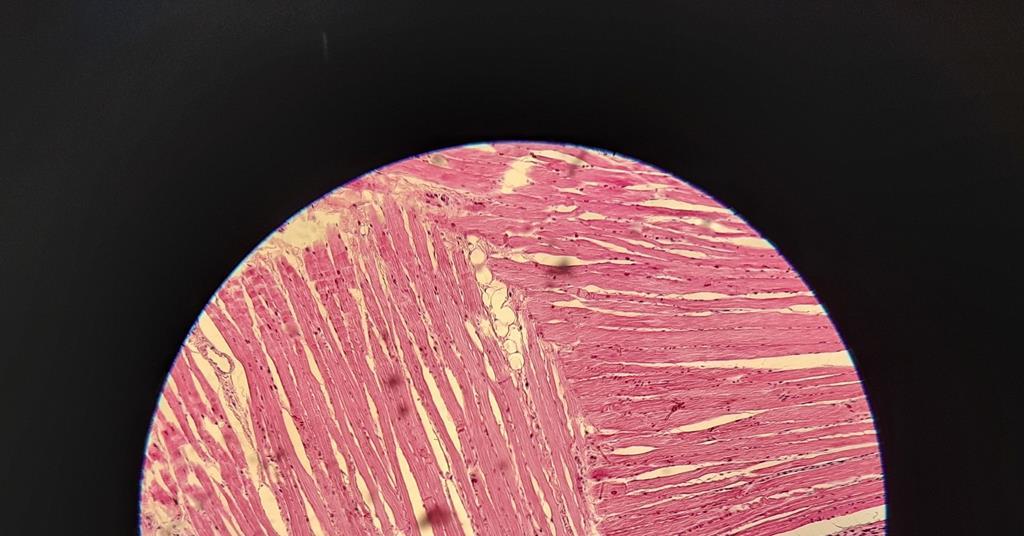 Dossier: Kweekvlees | Verdieping | ScienceLink