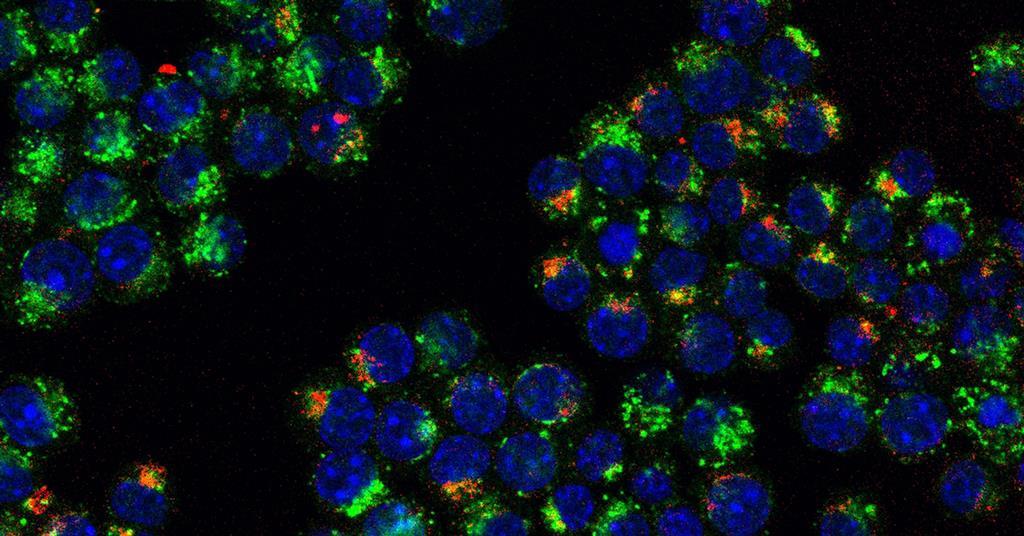 Overgelopen macrofagen lichten op | Nieuws | ScienceLink