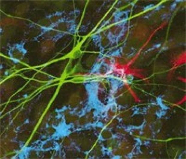 Huidcel wordt hersencel | Nieuws | ScienceLink