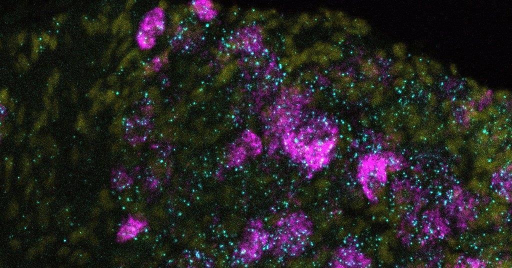 Gevoelige kanalen | Nieuws | ScienceLink