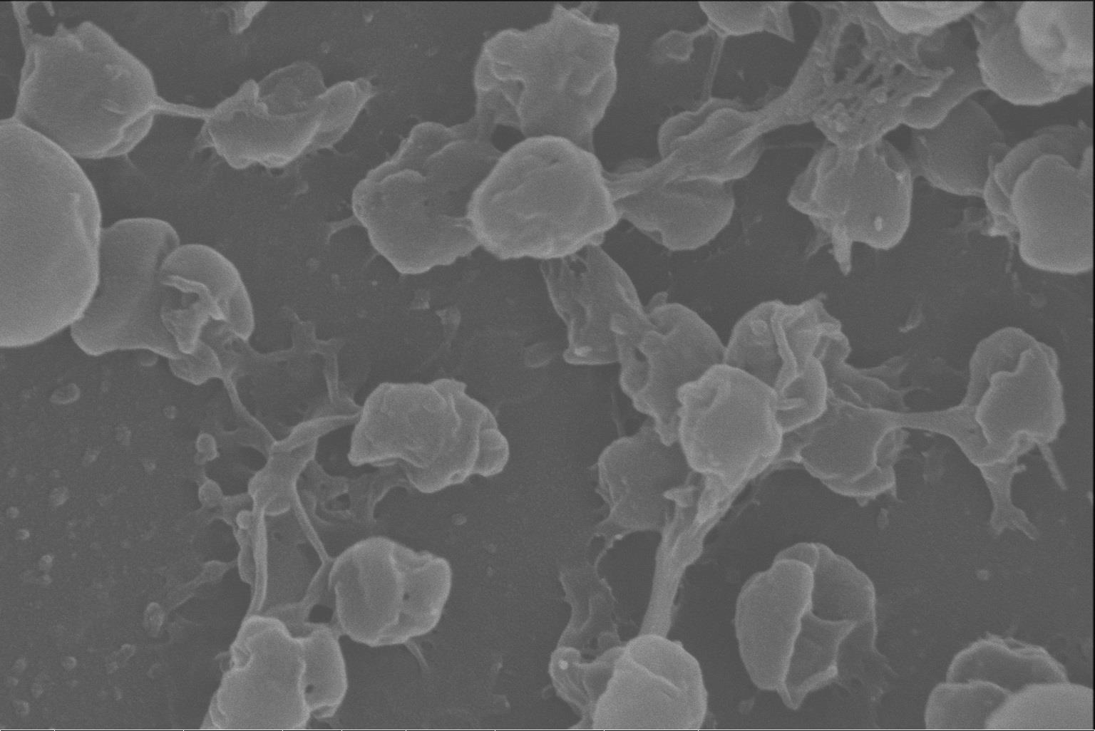 Ion coating tears apart bacteria | International | ScienceLink