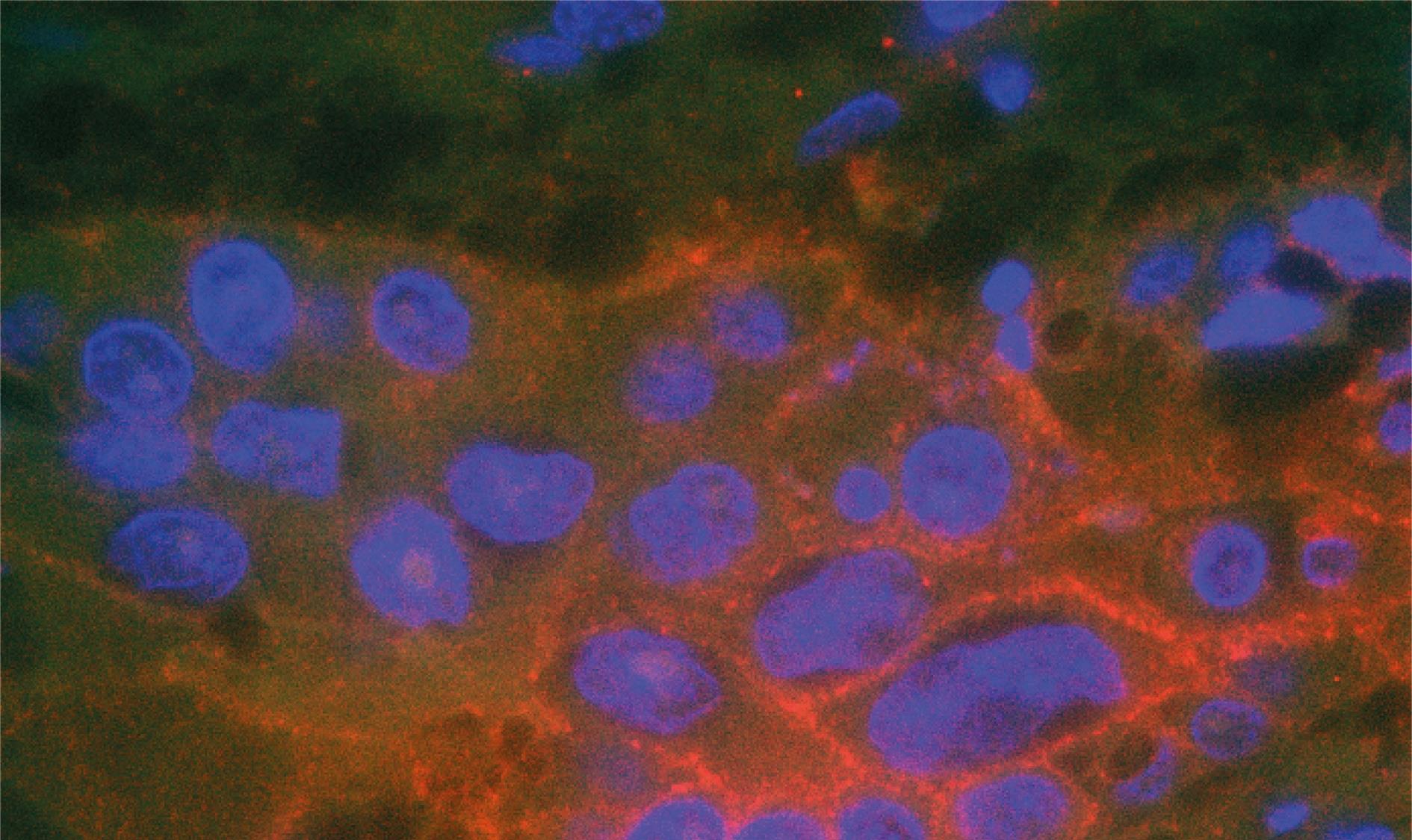 Chirurg zoekt tumor | Verdieping | ScienceLink